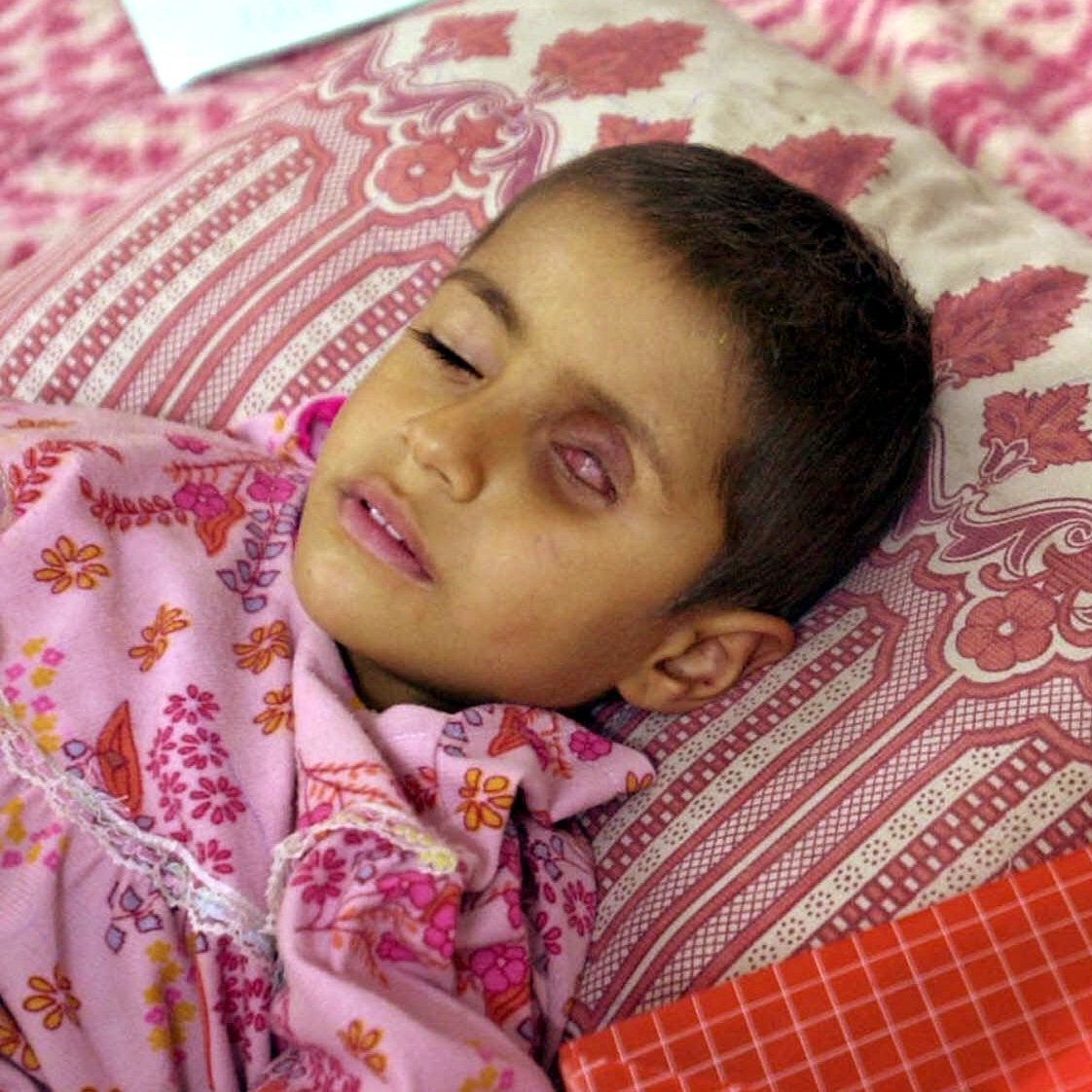 Eight years after battles, Iraqi children still paying the price of war