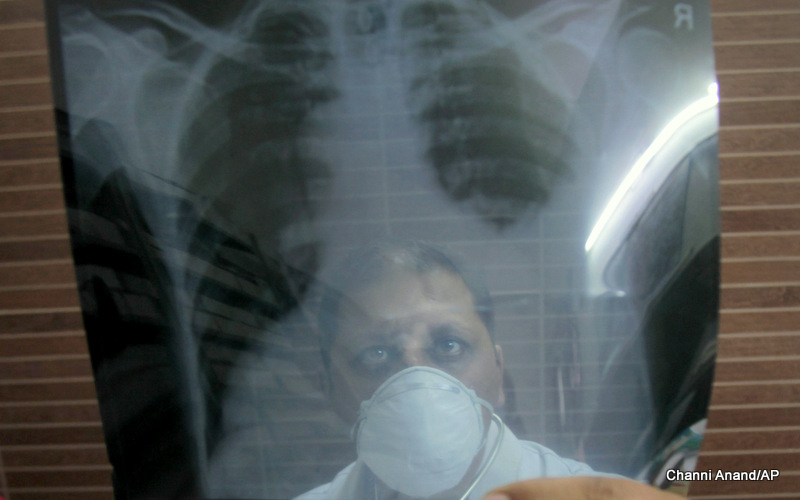 Google-X Moves To Map Perfect Human Health
